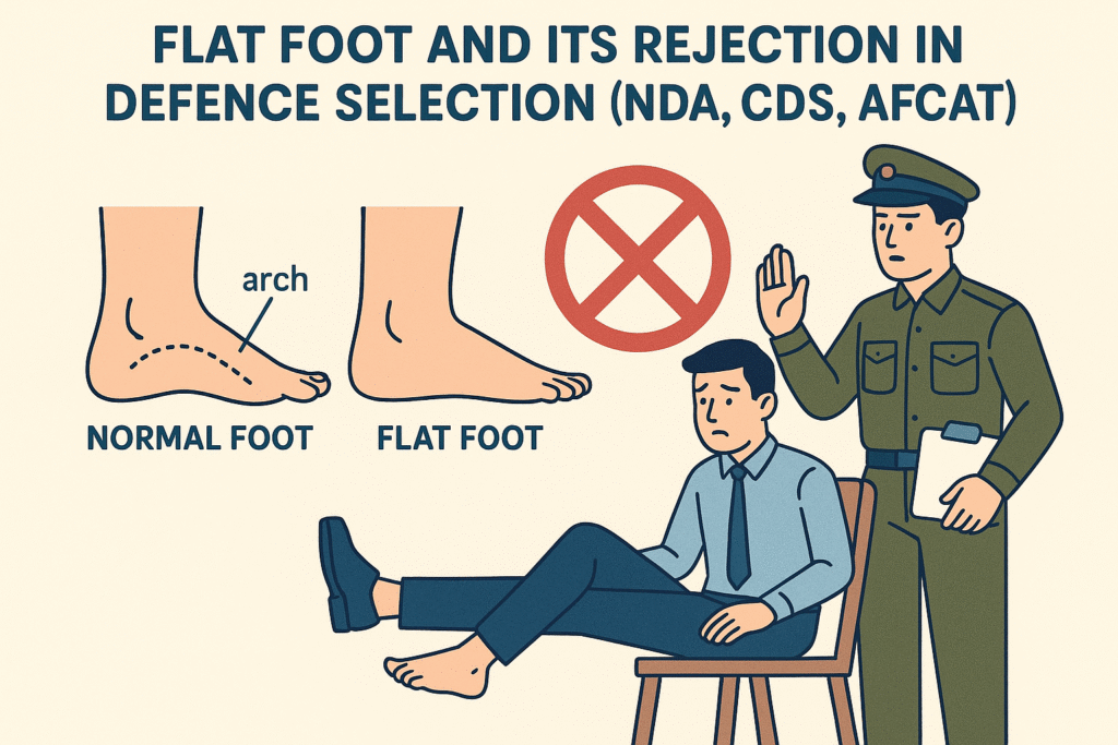 Flat Foot and Its Rejection in Defence Selection (NDA, CDS, AFCAT)